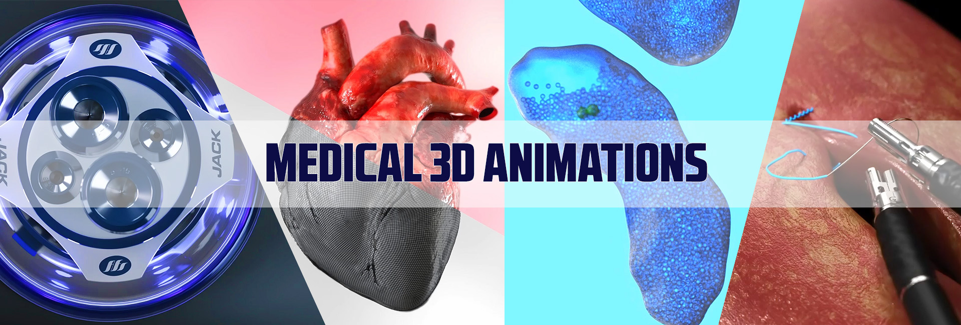 Medical 3D Animations - CG Folks